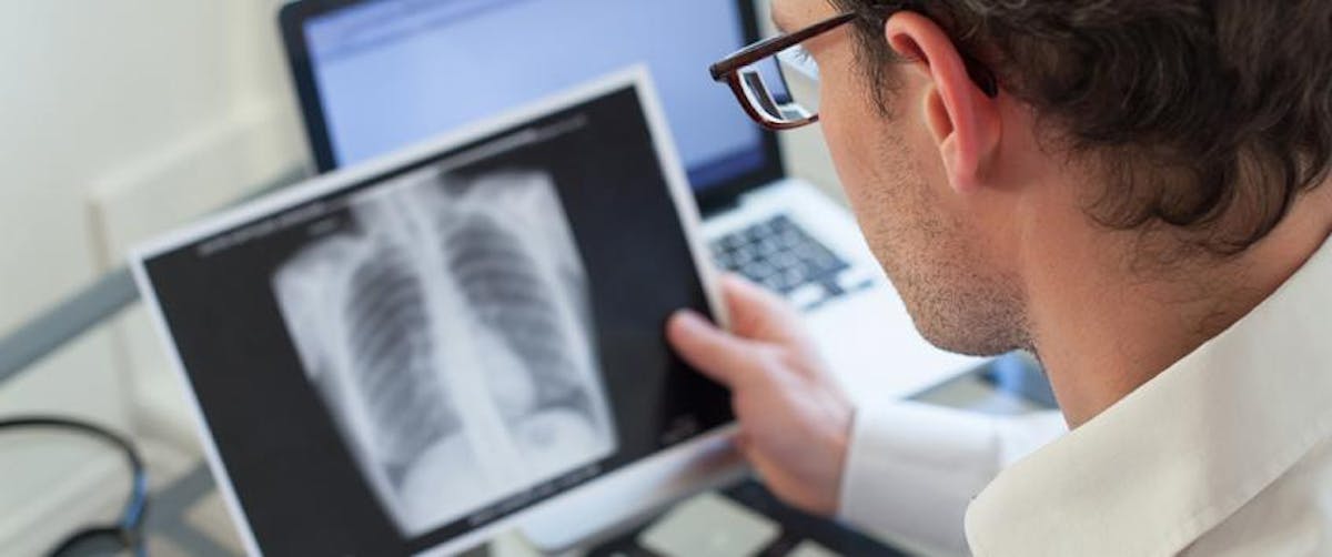 Victorian Tuberculosis Program | The RMH